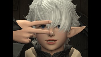 Better Hands for Meteion | XIV Mod Archive